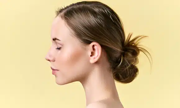 Does mewing work? The Truth Behind the Jaw-Sculpting Technique According to